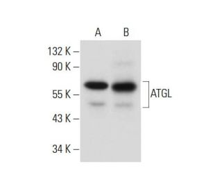 Anti-ATGL Antibody (F-7) | SCBT - Santa Cruz Biotechnology