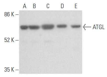 Anti-ATGL Antibody (F-7) | SCBT - Santa Cruz Biotechnology