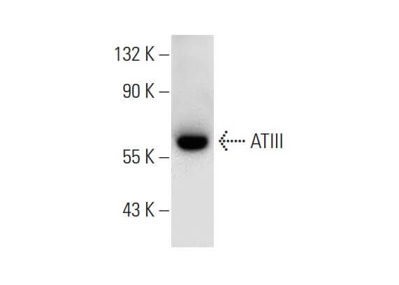 ATIII Antibody (H-7) | SCBT - Santa Cruz Biotechnology
