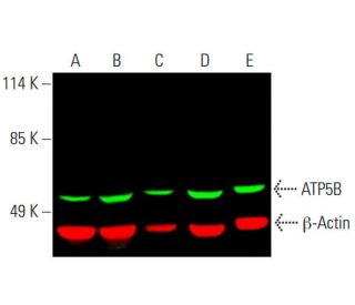 Anti-ATP5B Antibody (E-1) | SCBT - Santa Cruz Biotechnology