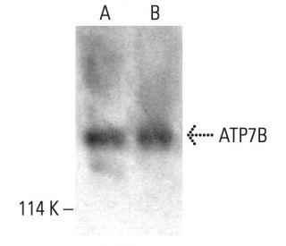 ATP7B Antibody (A-11) - Western Blotting - Image 403268