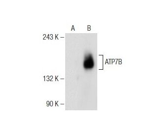 ATP7B Antibody (A-11) - Western Blotting - Image 147290