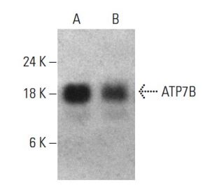 ATP7B Antibody (A-11) - Western Blotting - Image 401208