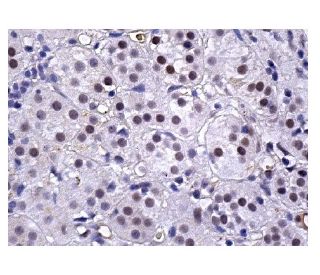 ATRX Antibody (D-5) - Immunohistochemistry - Image 156919