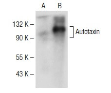 Anti-Autotaxin Antibody (E-12) | SCBT - Santa Cruz Biotechnology