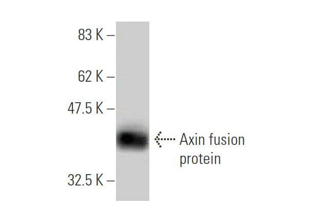 Anti-Axin Antibody (2B11) | SCBT - Santa Cruz Biotechnology