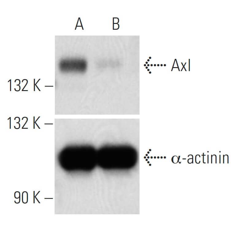 AxlsiRNA (h)，shRNA和慢病毒颗粒基因沉默产品 | SCBT - Santa Cruz Biotechnology