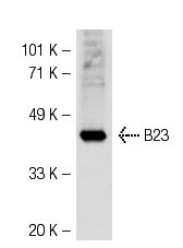 Anti-B23/Nucleophosmin Antibody (3F291) | SCBT - Santa Cruz Biotechnology