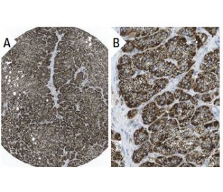 BACE Antibody (61-3E7) - Immunohistochemistry - Image 37978