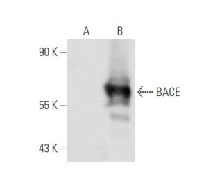 Anti-BACE Antibody (61-3E7) | SCBT - Santa Cruz Biotechnology