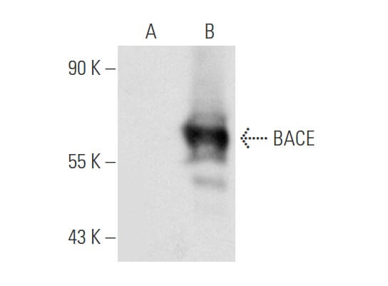 Anti-BACE Antibody (61-3E7) | SCBT - Santa Cruz Biotechnology