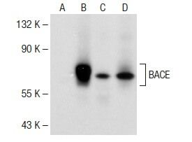BACE Antibody (61-3E7) | SCBT - Santa Cruz Biotechnology