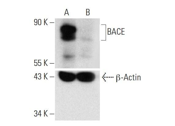 BACE Antibody (A-12) | SCBT - Santa Cruz Biotechnology