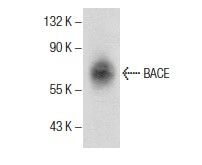 BACE Antibody (H-10) | SCBT - Santa Cruz Biotechnology