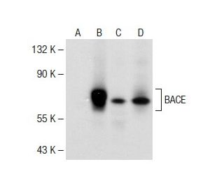 BACE Antibody (M-83) | SCBT - Santa Cruz Biotechnology