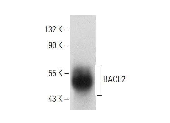 BACE2抗体 (F-12) | SCBT - Santa Cruz Biotechnology
