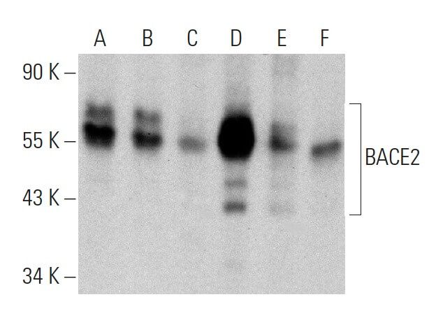 BACE2 Antibody (H-3) | SCBT - Santa Cruz Biotechnology
