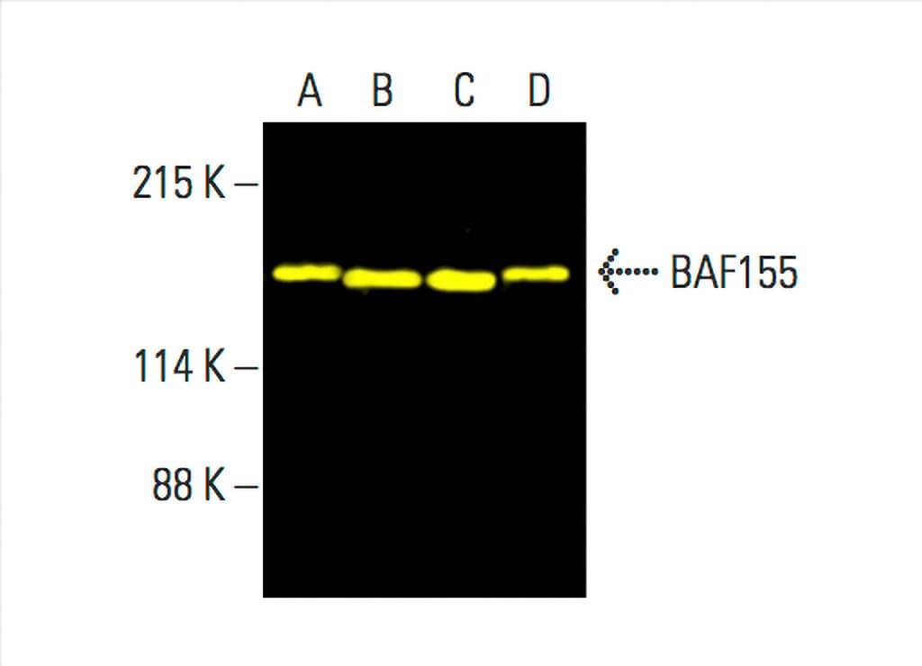 BAF155 Antibody (DXD7) | SCBT - Santa Cruz Biotechnology