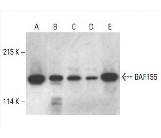 BAF155 Antibody (DXD7) | SCBT - Santa Cruz Biotechnology