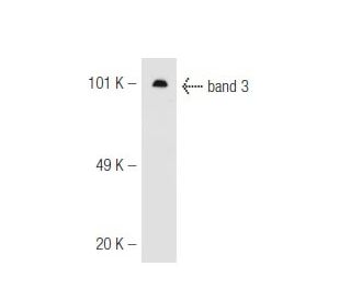 Anti-band 3 Antibody (A-6) | SCBT - Santa Cruz Biotechnology