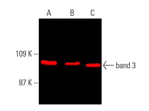 Anti-band 3 Antibody (A-6) | SCBT - Santa Cruz Biotechnology