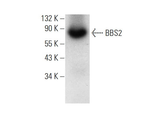 Anti-BBS2 Antibody (A-12) | SCBT - Santa Cruz Biotechnology