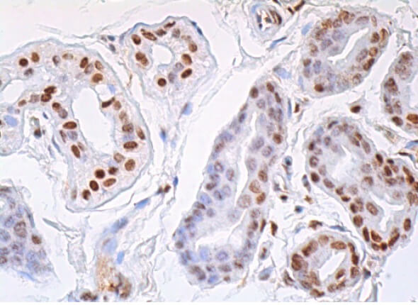 Anti-Bcl-11b Antibody (F-4) | SCBT - Santa Cruz Biotechnology