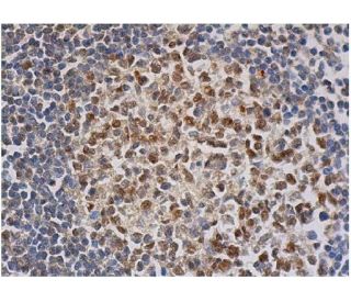 Anti-Bcl-6 Antibody (D-8) | SCBT - Santa Cruz Biotechnology