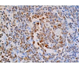 Anti-Bcl-6 Antibody (D-8) | SCBT - Santa Cruz Biotechnology