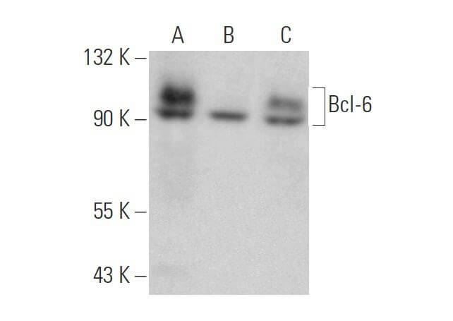 Anti-Bcl-6 Antibody (D-8) | SCBT - Santa Cruz Biotechnology
