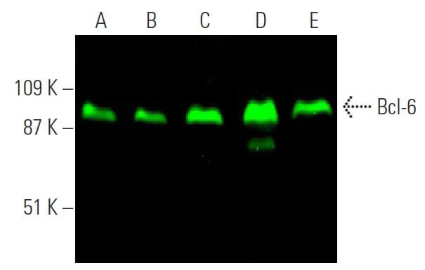 Anti-Bcl-6 Antibody (D-8) | SCBT - Santa Cruz Biotechnology