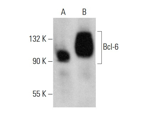 Anti-Bcl-6 Antibody (D-8) | SCBT - Santa Cruz Biotechnology