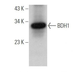 Anti-BDH1 Antibody (G-5) | SCBT - Santa Cruz Biotechnology