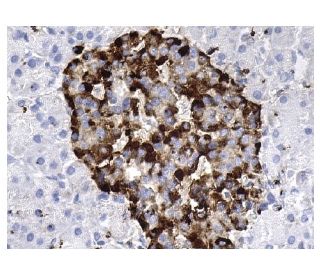 β-2-Microglobulin Antibody (BBM.1) - Immunohistochemistry - Image 156501