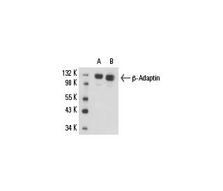 Anti-β-Adaptin Antibody (A-5) | SCBT - Santa Cruz Biotechnology
