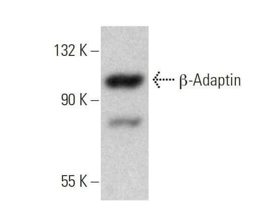 Anti-β-Adaptin Antibody (A-5) | SCBT - Santa Cruz Biotechnology