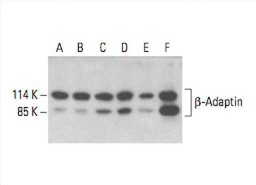 Anti-β-Adaptin Antibody (A-5) | SCBT - Santa Cruz Biotechnology