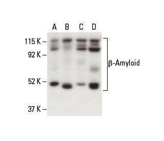 β-Amyloid Antibody (B-4) - Western Blotting - Image 398280