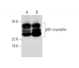 β-crystallin Antibody (FL-252) | SCBT - Santa Cruz Biotechnology