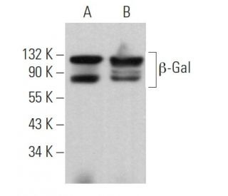β-Gal Antibody (B-12) - Western Blotting - Image 361869