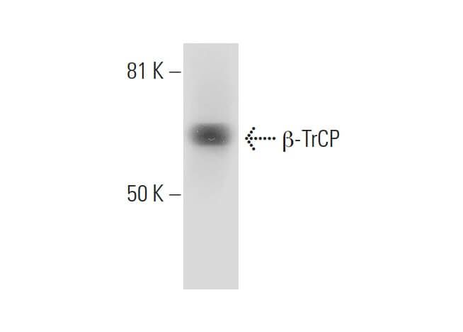β-TrCP抗体 (C-6) | SCBT - Santa Cruz Biotechnology