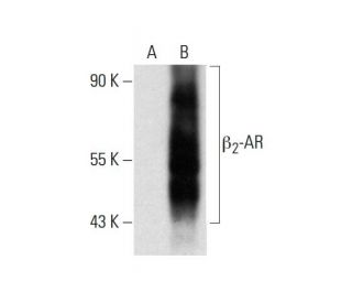 β 2 -AR Antibody (E-3) - Western Blotting - Image 144834
