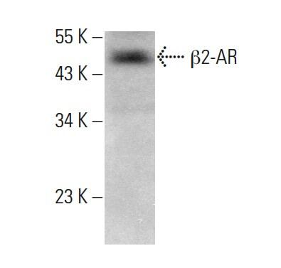 Anti-beta 2 Adrenergic Receptor/ADRB2/β2-AR Antibody (E-3) | SCBT ...