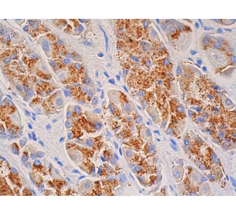 β2-AR Antibody (H-20) | SCBT - Santa Cruz Biotechnology