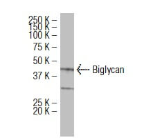 Anti-Biglycan Antibody (3E2) | SCBT - Santa Cruz Biotechnology