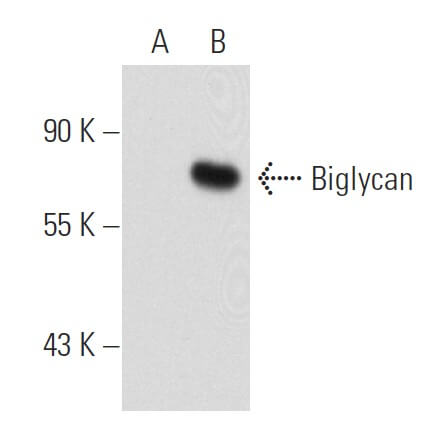 Anti-Biglycan Antibody (3E2) | SCBT - Santa Cruz Biotechnology