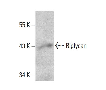 Anti-Biglycan Antibody (910E2) | SCBT - Santa Cruz Biotechnology