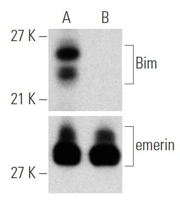 Bim siRNA (h), shRNA and Lentiviral Particle Gene Silencers | SCBT ...
