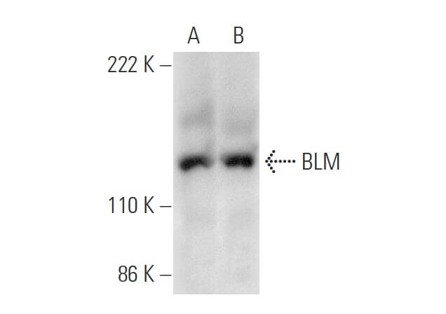 Anti-BLM Antibody (B-4) | SCBT - Santa Cruz Biotechnology