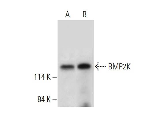 BMP2K Antibody (E-8) | SCBT - Santa Cruz Biotechnology